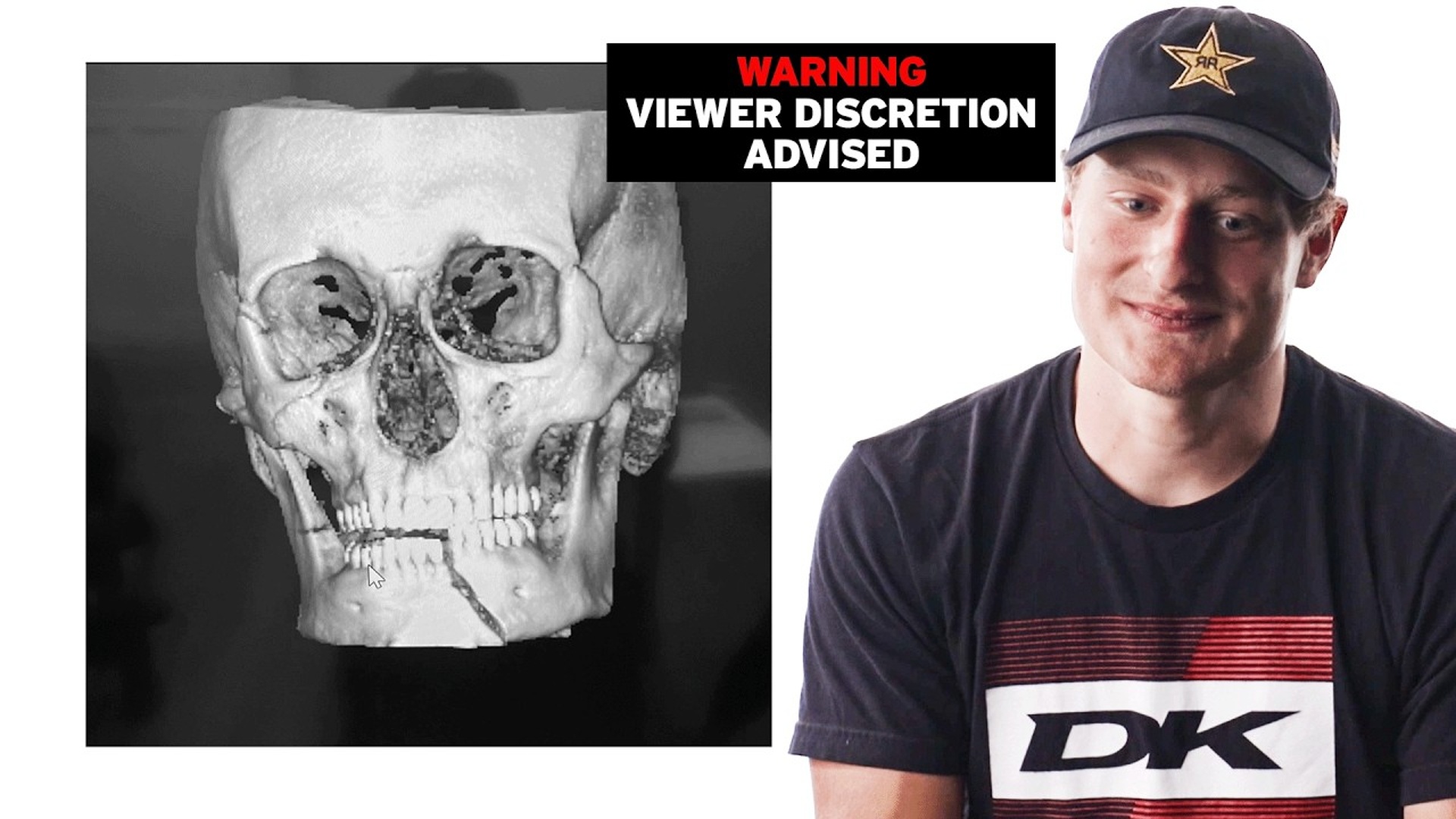 Watch Marcus Christopher: Pushing Through Online | DAZN US